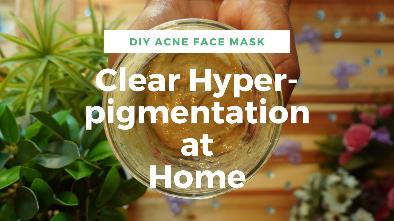 Bright skin face mask | Get rid of hyperpigmentation at home - YouTube