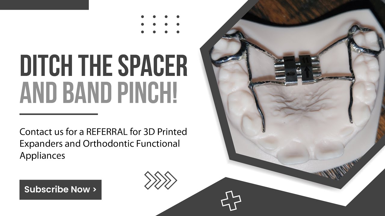 ODL Appliances and 3d Printed Expander - YouTube