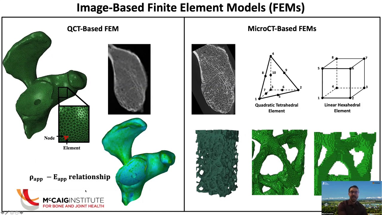 Digital Volume Correlation in Bone Research by Dr. Nikolas Knowles ...