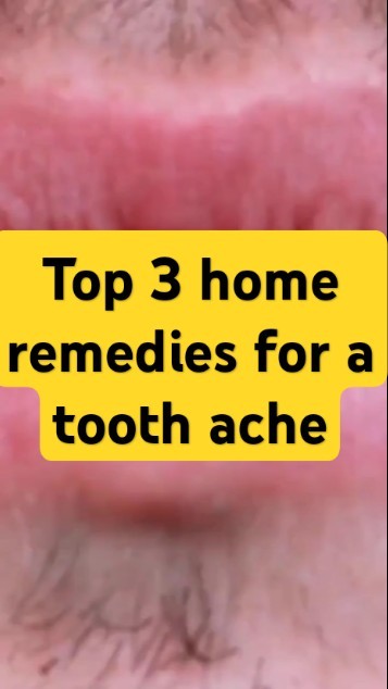 Top 3 HOME REMEDIES for TOOTH ACHE RELIEF 🦷 | NATURAL WAYS to STOP ...