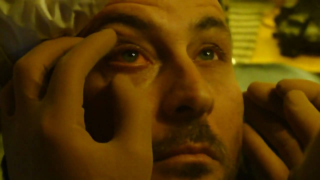 Dig metal out of my eye with needle!!!!!! - YouTube