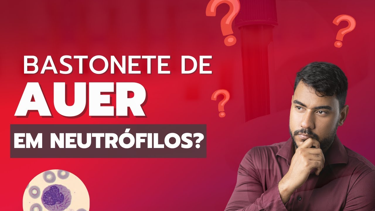 Bastonete de Auer em neutrófilos ? - YouTube