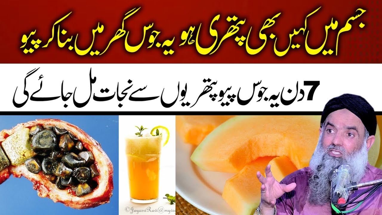 Pitay Ki Pathri Ka elaj | Masanay Ki Pathri Ka elaj | Har Qisam Ki Pathri ka elaj |nDr Sharafat ...