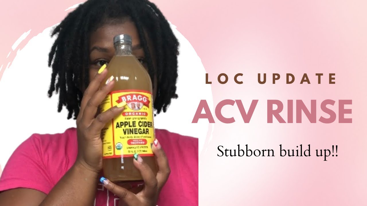 ACV Rinse | Loc Journey | Locs w/ Alopecia - YouTube