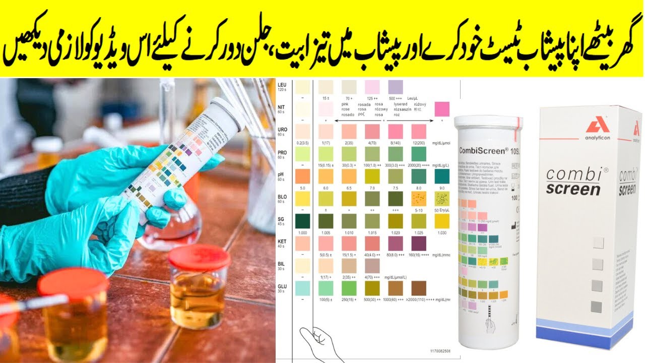 How to Perform Urine Examination with Acidity & Alkaline | Knowledge ...