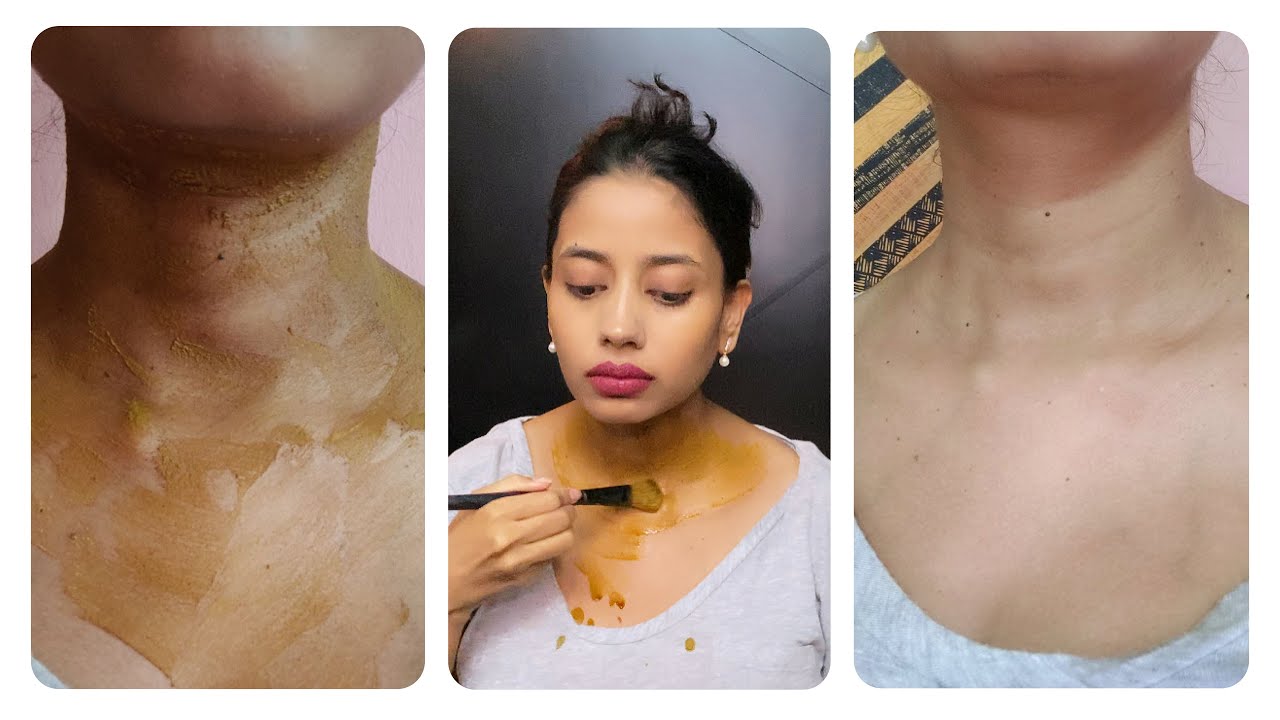 VLOGMAS DAY 4 - How to get rid of dark neck easily and quickly - YouTube