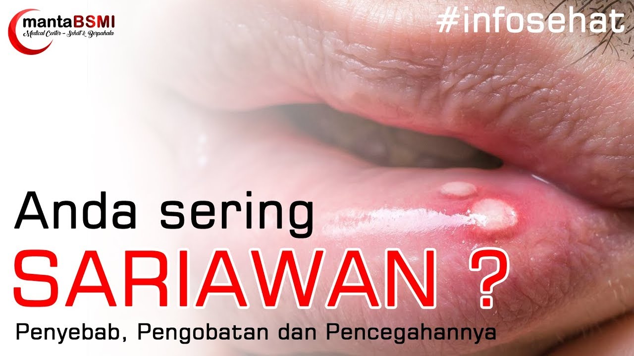 Hal yang perlu anda ketahui tentang SARIAWAN - YouTube