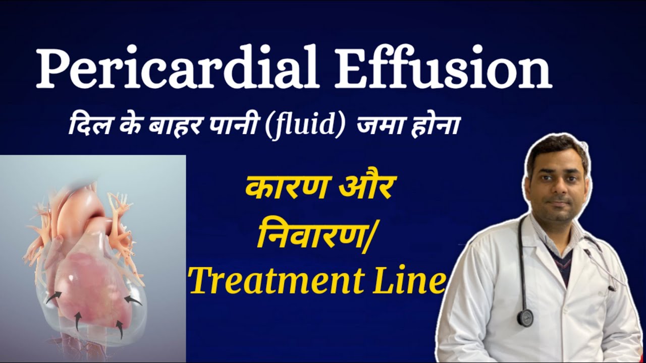 Pericardial effusion in hindi detail || pericardial effusion treatment ...