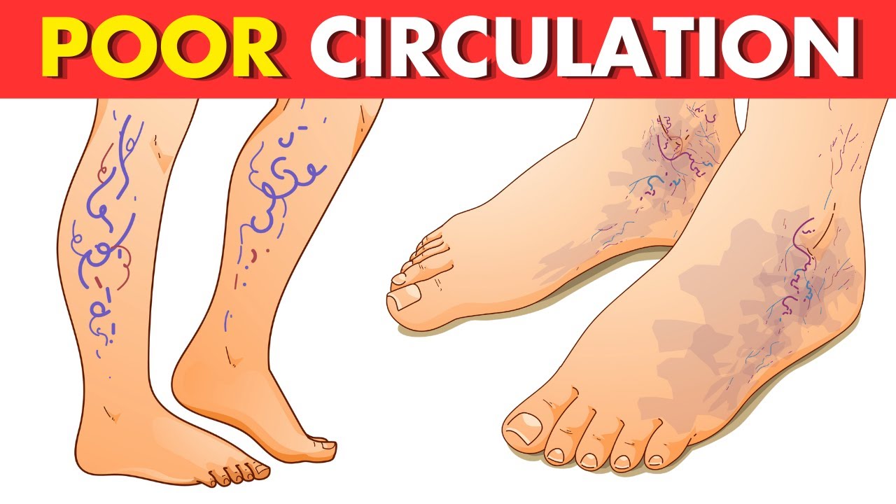 5 Warning Signs Of Poor Circulation And How To Fix It YouTube 5-warning-signs-of-poor-circulation-and-how-to-fix-it-youtube