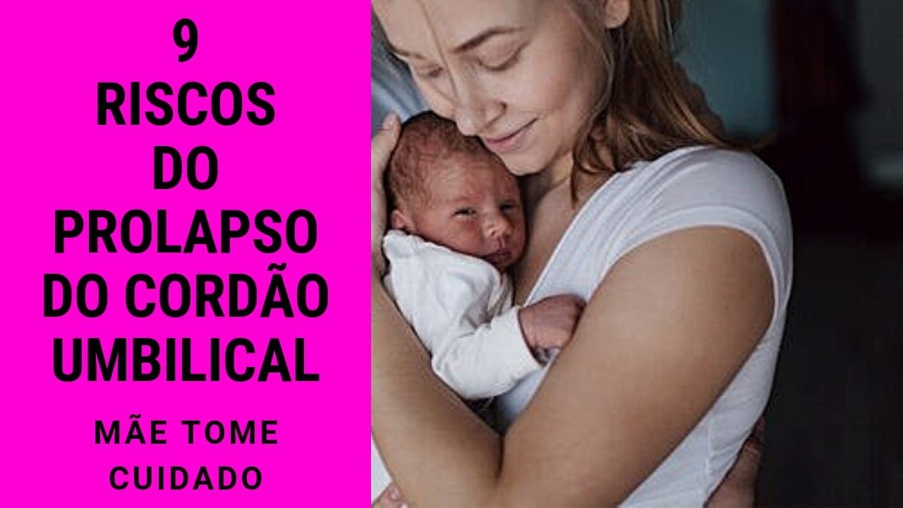 9 RISCOS do PROLAPSO do CORDÃO UMBILICAL (mãe tomo cuidado) - YouTube