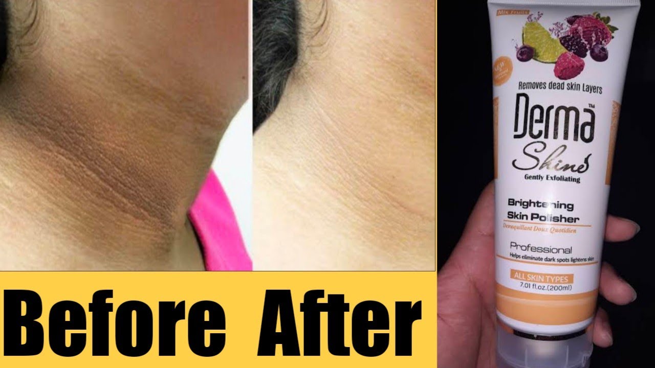 Derma Shines Skin Polisher Review by Kulsoom Faraz/ Get Rid Of Dead ...