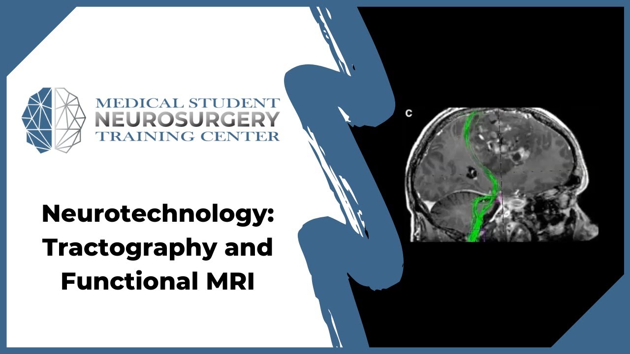 Neurotechnology: Tractography and Functional MRI - YouTube