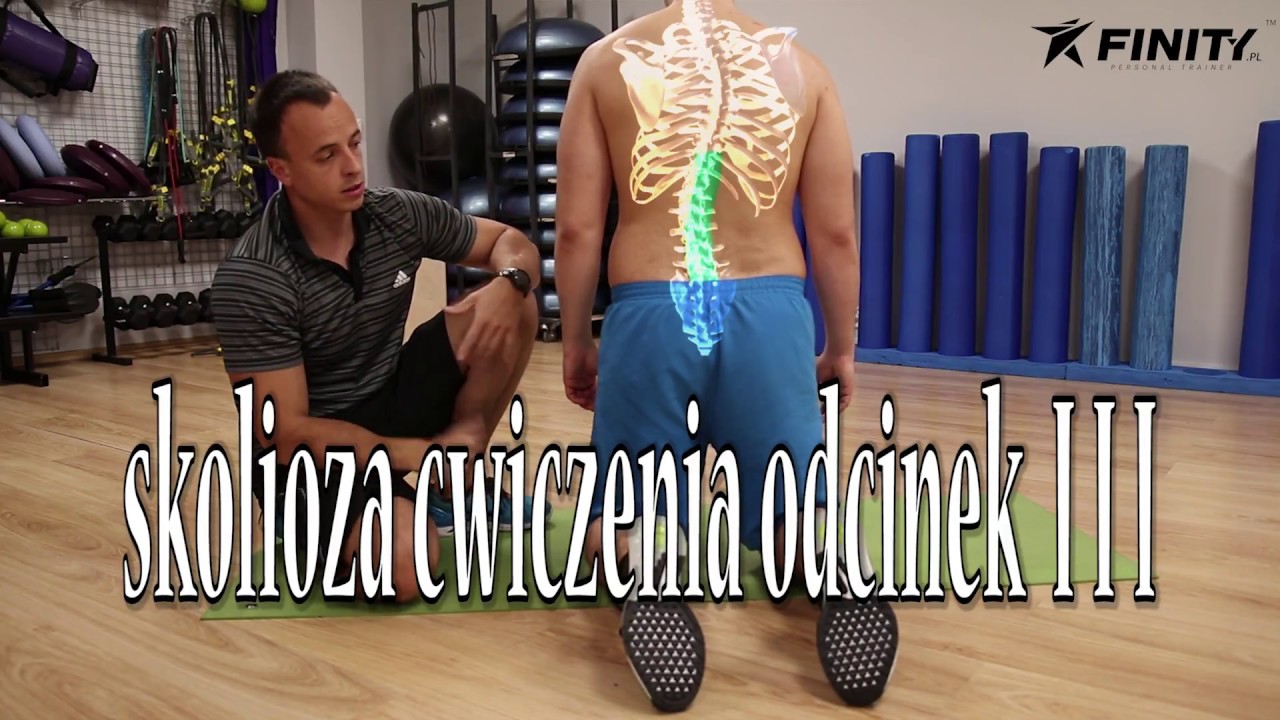 Skolioza (skrzywienie kręgosłupa) lędźwiowy 3/3 - YouTube