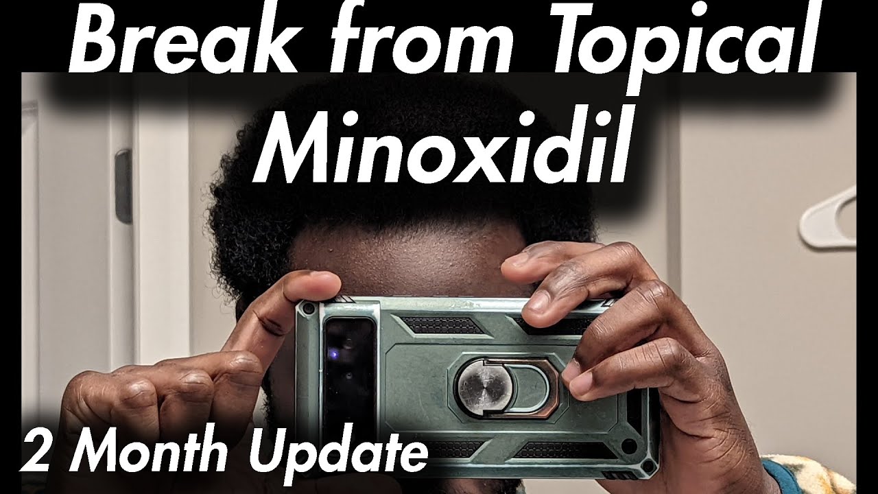Break From Topical Minoxidil How Long Until Hair Fall Self break-from-topical-minoxidil-how-long-until-hair-fall-self