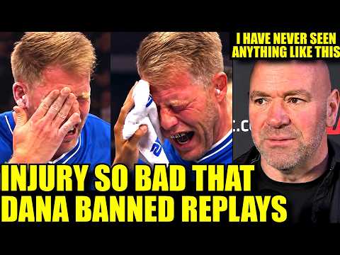 Dana reacts to WORST injury in History of UFC/Slap + Justin warns Ilia's next opponent + Costa fedup