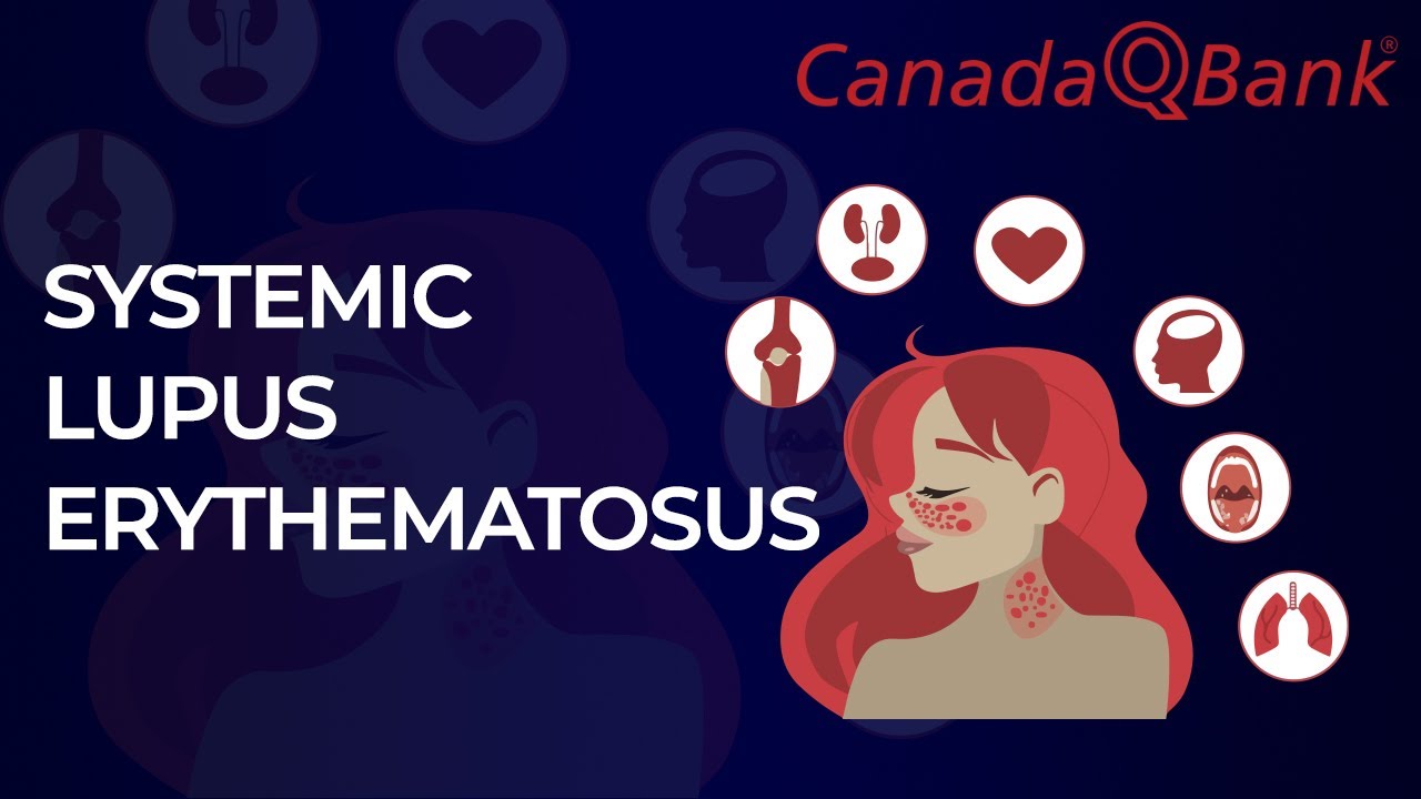 Systemic Lupus Erythematosus Explained | Diagnosis, Antibodies ...