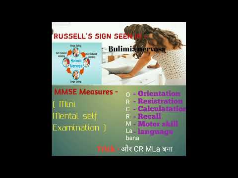 Russell's sign in bulimia nervosa - YouTube