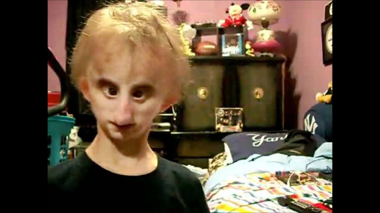 chicken boy - YouTube