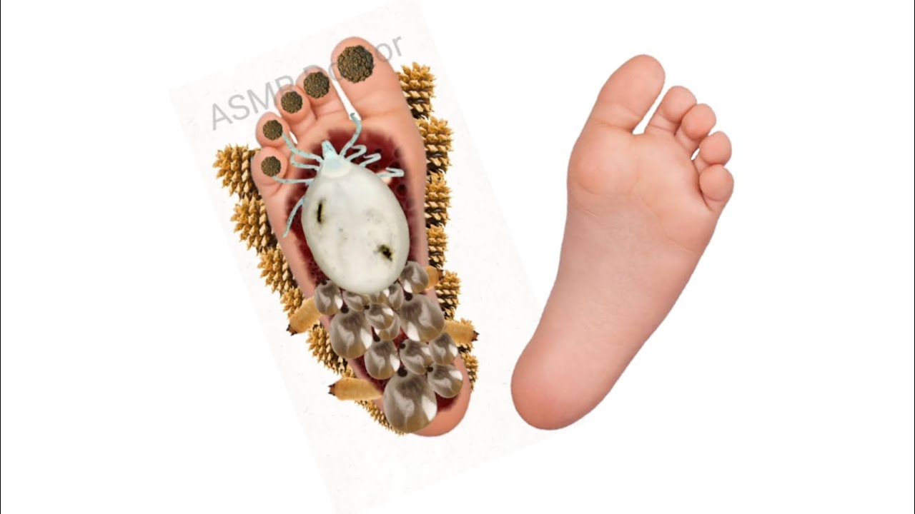 ASMR dog ticks and maggots removal animation| severely injured ...