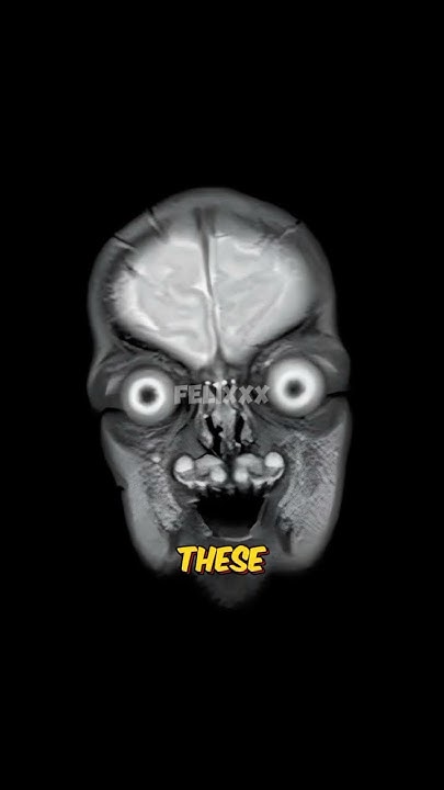 Creepy Mri Scan Images Youtube