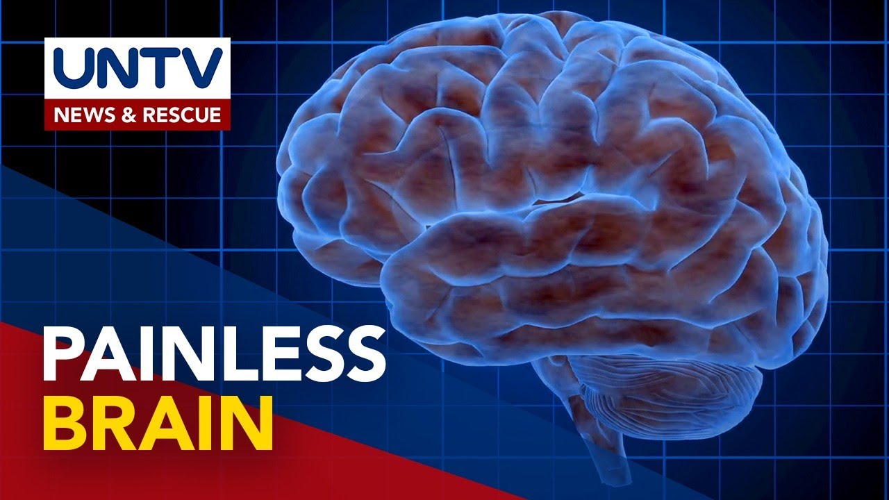 Huwat Trivia: Utak, Bahagi ng Katawan na Hindi Nakararamdam ng Sakit ...