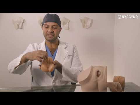 I dislike the color of my Vagina and Labia, what can i do?