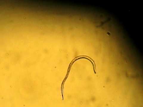 Strongyloides stercoralis filariform larvae - YouTube