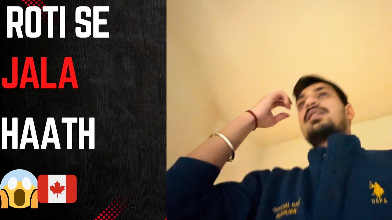 Roti se Jala bhai ka haat 🥺🇨🇦 || Vlog -115 - YouTube