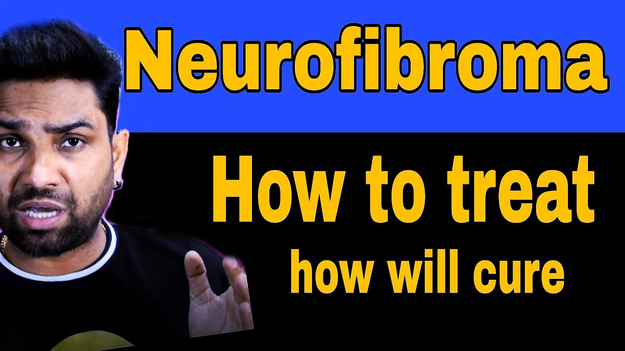 how will cure neurofibroma #neurofibroma #nf1 #neurofibromatosis #lipoma - YouTube