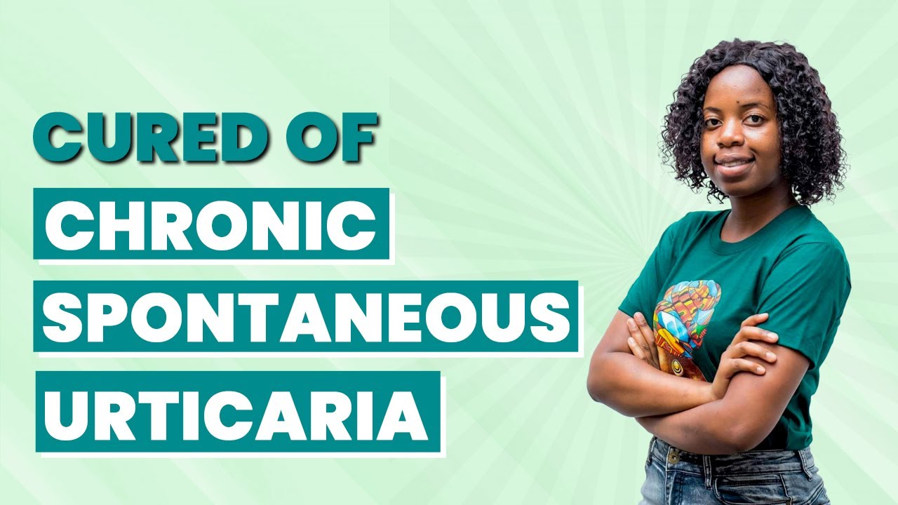 Cured of chronic spontaneous urticaria by me. - YouTube