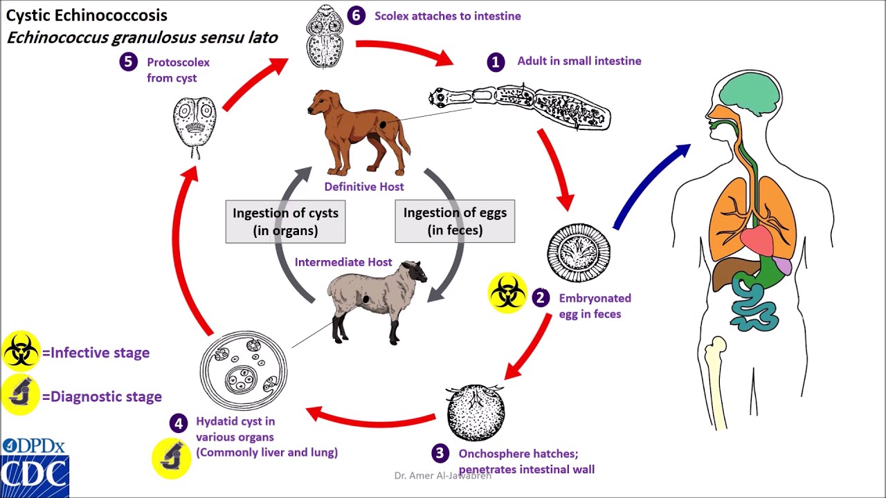 Echinococcus Granulosus Liver