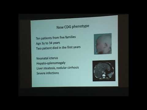 Eva Morava MD, PhD - ATP6AP1 Deficiency Causes Liver Disease and ...