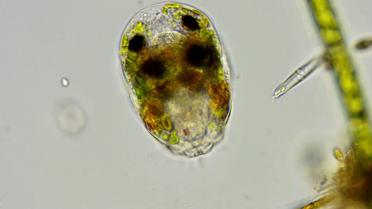 Rotifer Ascomorpha with dark defecation reservoirs - YouTube