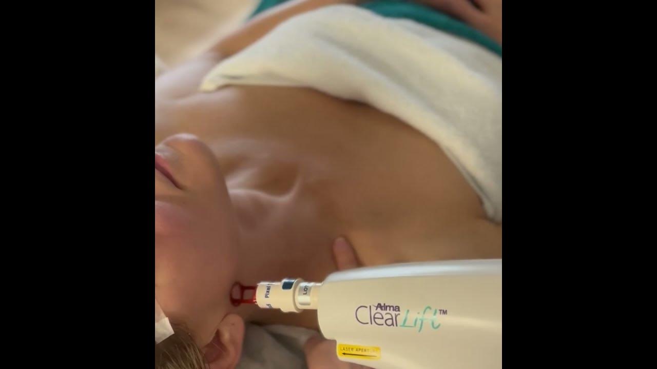 ClearLift 4D in action - YouTube