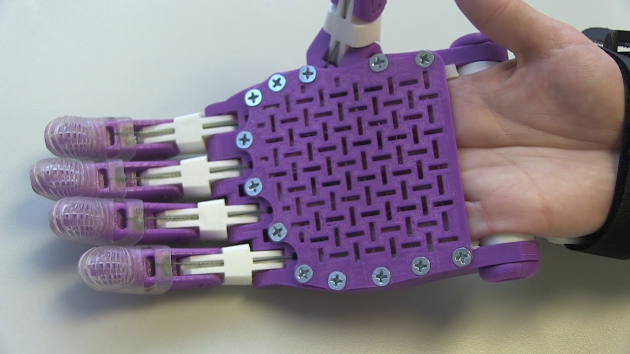 The Phoenix 3-D e-NABLE Prosthetic Hand, CNS High School - YouTube