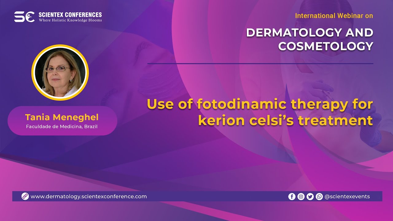 Use of fotodinamic therapy for kerion celsi’s treatment | Dermatology ...