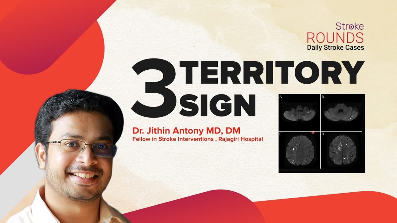Three territory sign - Stroke Rounds 21 - YouTube