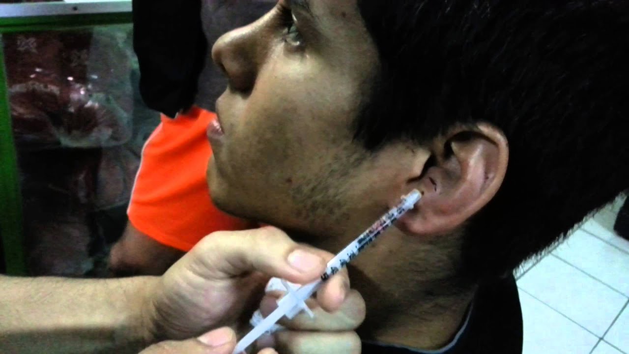 OLIMPO ACADEMY - DRENADO DE OREJA - YouTube