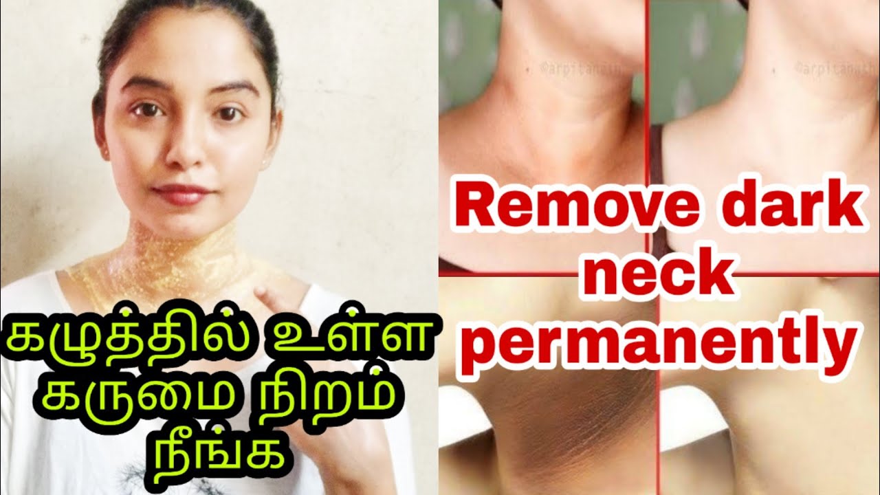 How to get rid of dark neck permanently? powerful 2 steps for neck ...