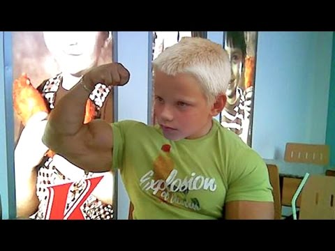 Mutasyon Geçirip İlginç Güçler Kazanan 5 İnsan