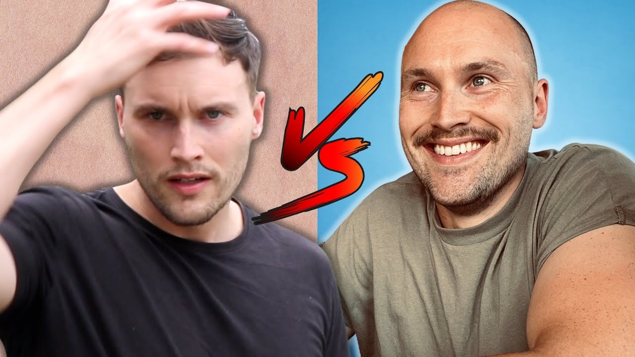 BALDING To BALD - MY BREAKTHROUGH THOUGHT PROCESS - YouTube