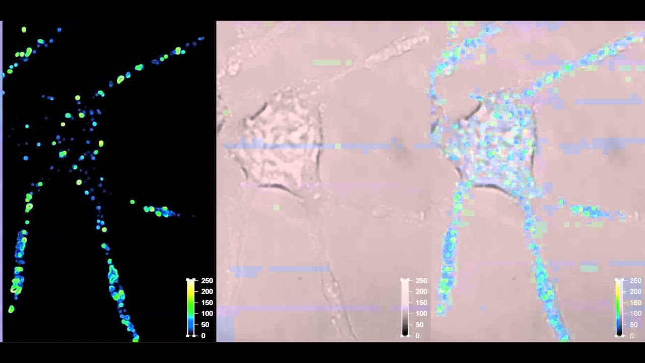 Real time confocal imaging of vesicles trafficking in living neuron ...
