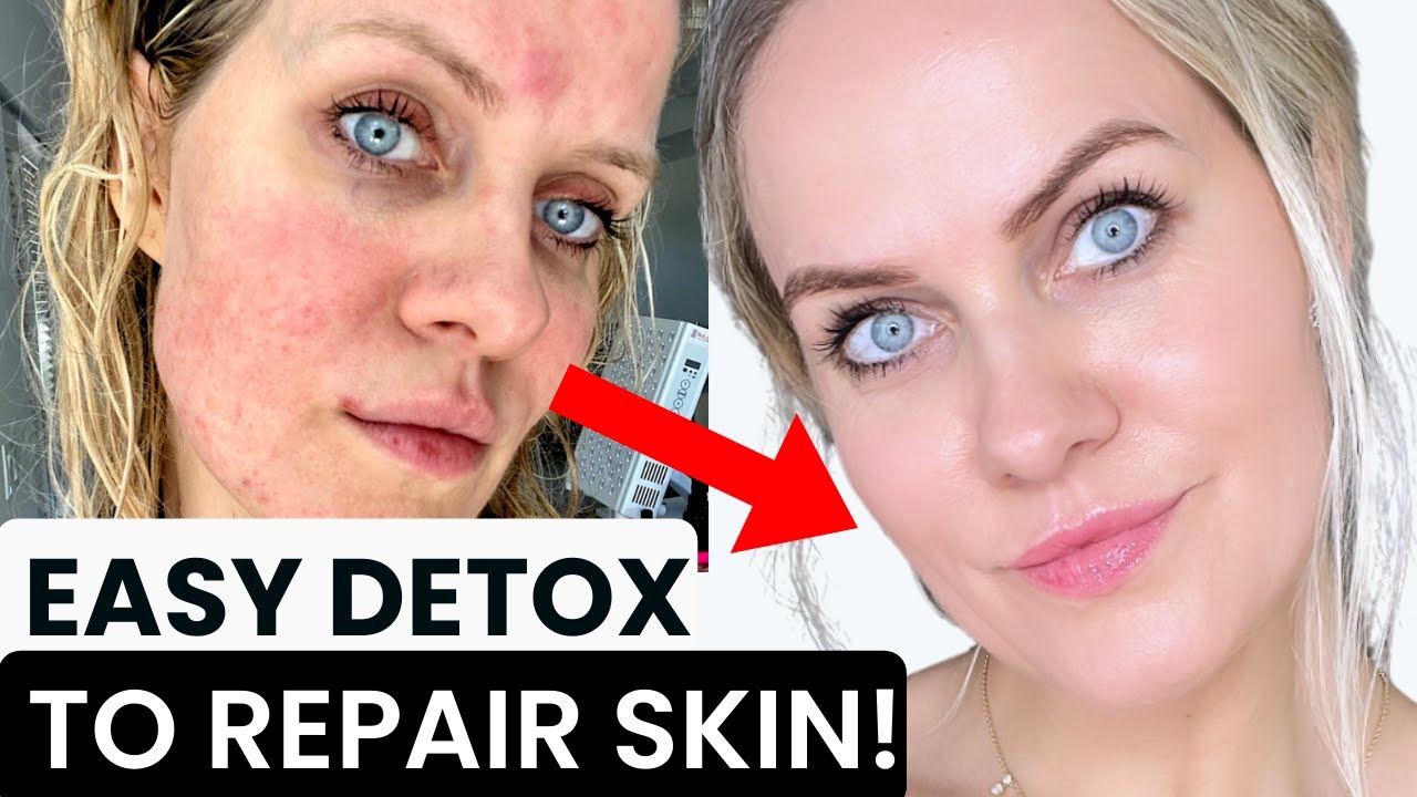 HOW I NATURALLY DETOXED MY BODY FROM TOXINS AND REVERSED AUTOIMMUNE ...