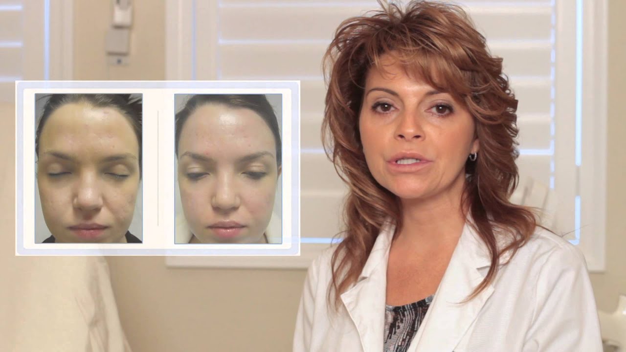 JVAI FOUR STEP APPROACH for Beautiful, Healthy, Young Looking Skin ...
