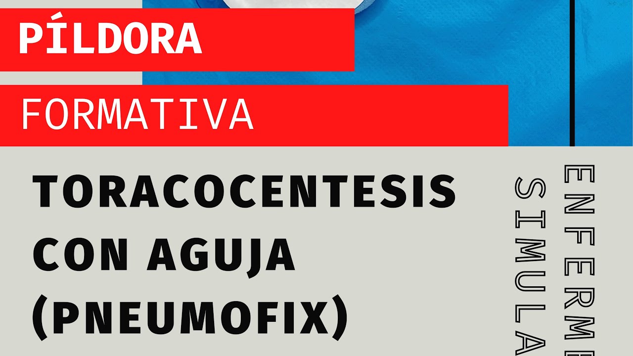 Toracocentesis con aguja. Uso del pneumofix - YouTube