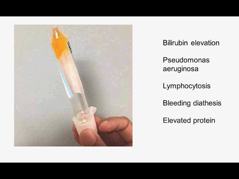 Charité Clinical Journal Club by Fred Luft - 18.3.2016 - YouTube