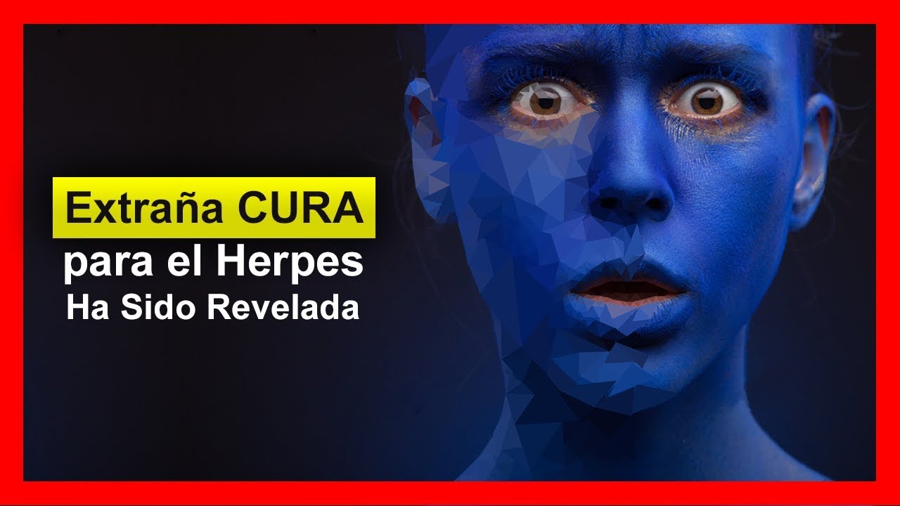 Como Curar El Herpes Con La Gu a DEFINITIVA Como Curar El Herpes Genital YouTube como-curar-el-herpes-con-la-gu-a-definitiva-como-curar-el-herpes-genital-youtube