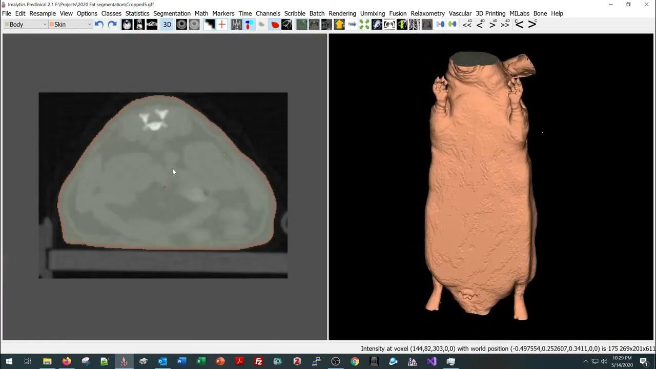 Fat Segmentation - Imalytics Preclinical Application Demo - YouTube