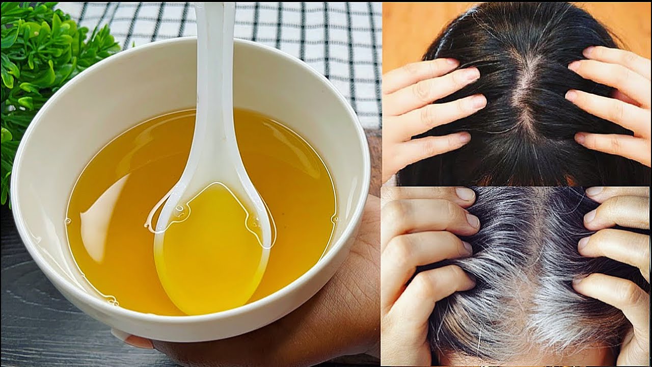 Saliid timaha madobeyso iyo timaha bixnayo sugeysen 1week | How to cure ...