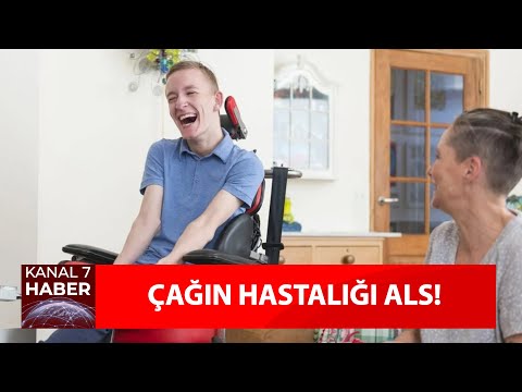 Çağın Hastalığı ALS! Beyin ve Kas Sinirleri İşlevini Yitiriyor!